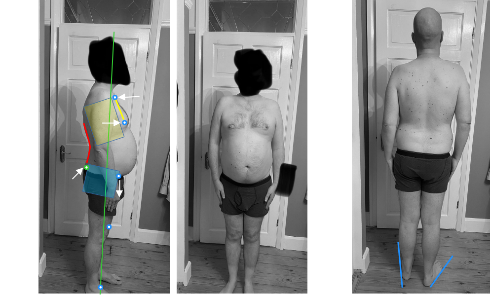 Posture assessment: Loneranger80 | Good Posture Studio Posture assessment: Loneranger80 | Good Posture Studio